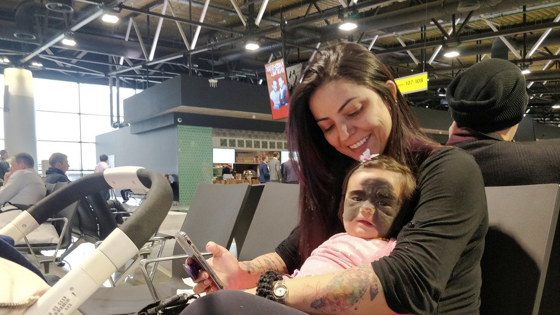 La madre de la bebé nacida en EE.UU. con 'máscara de Batman' muestra ...