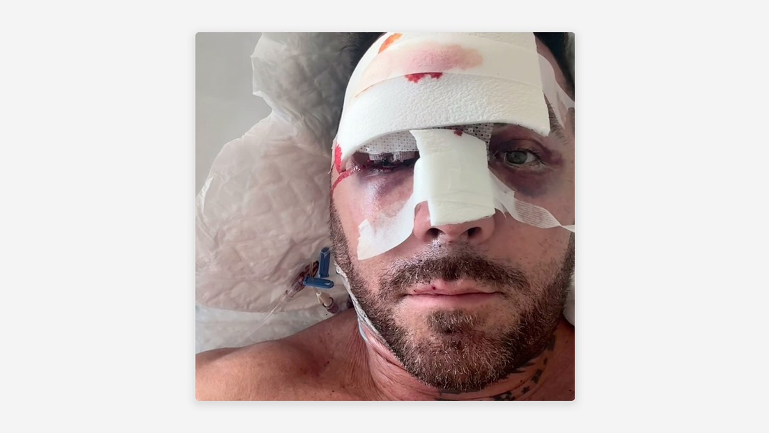 Hospitalizado el polémico 'influencer' 'Ferrariman' tras accidentarse ...